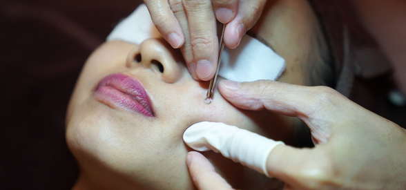 Pore Extraction Facial - My Cozy Room Boutique Spa - Gifting Made Easy ...